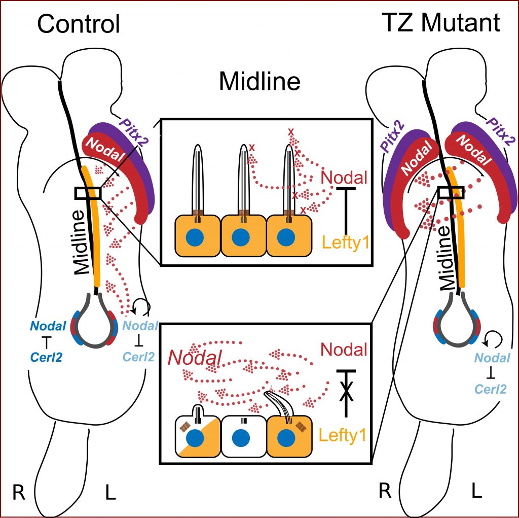 Presence of midline cilia supersedes the expression of Lefty1 in ...