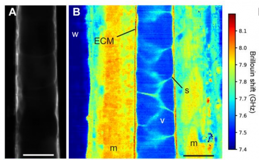 Imaging mechanical properties of sub-micron ECM in live zebrafish using ...