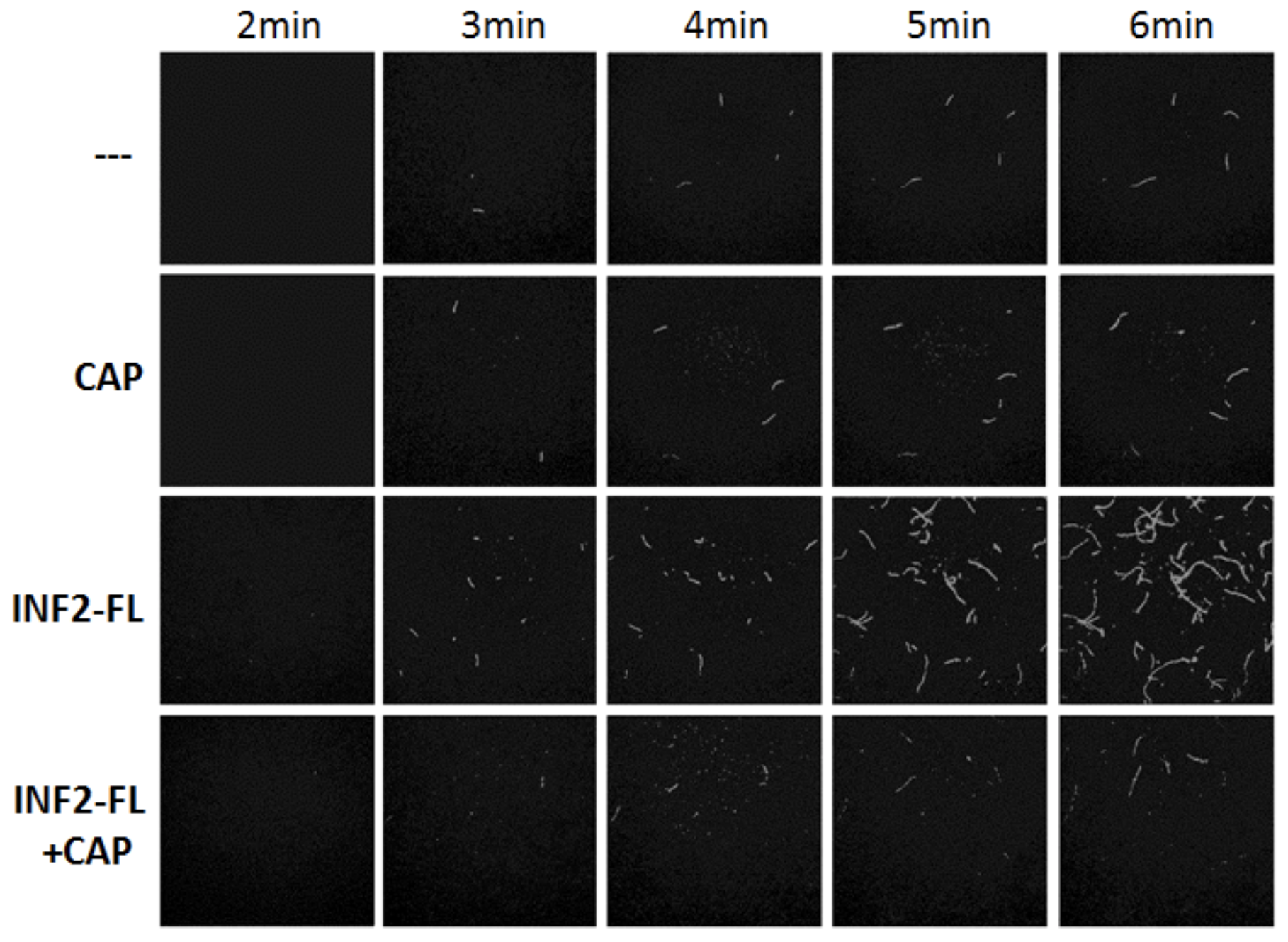 A complex containing lysine-acetylated actin inhibits the formin INF2 ...