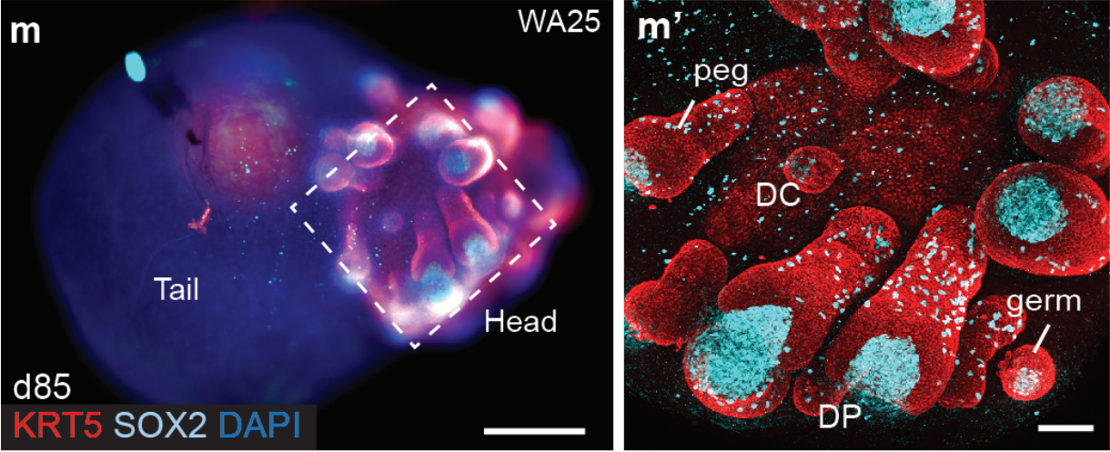 Hair-bearing human skin generated entirely from pluripotent stem cells ...