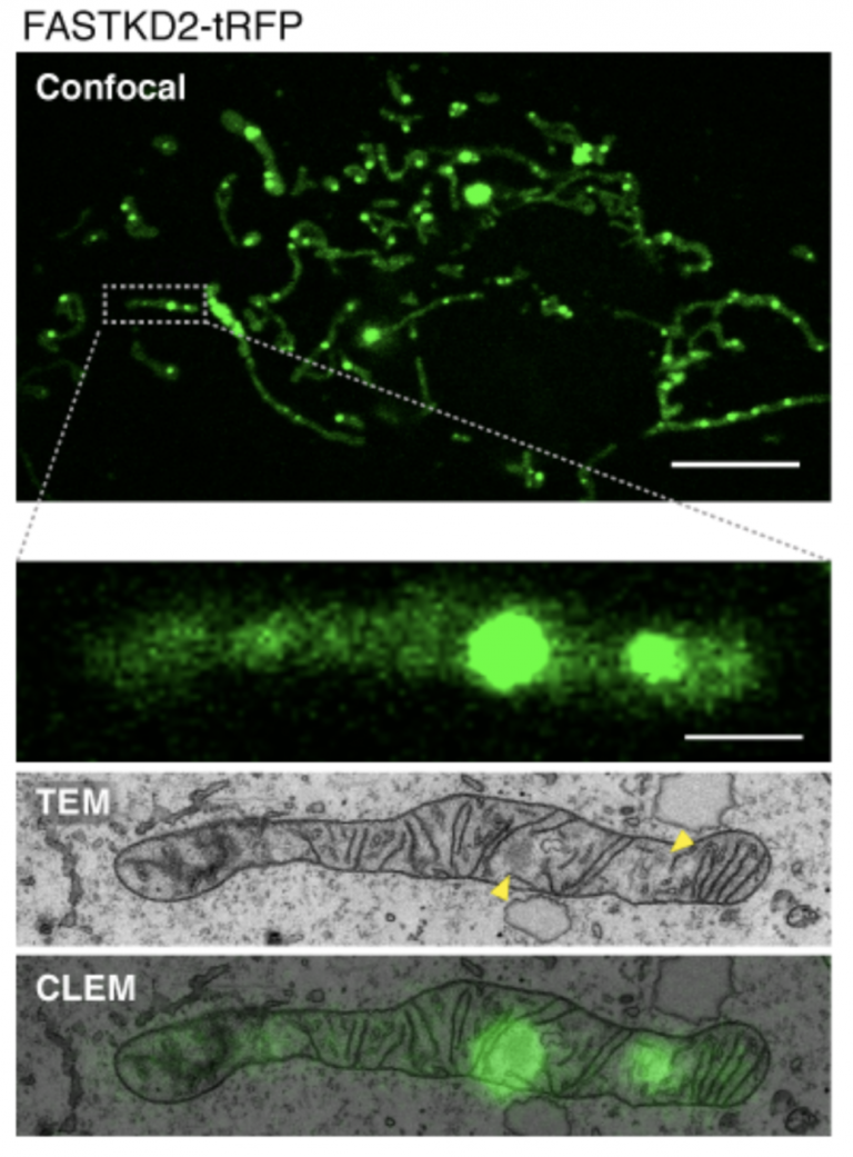 Mitochondrial RNA granules are fluid condensates, positioned by ...
