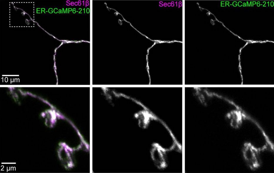 Fluorescence Dynamics In The Endoplasmic Reticulum Of A
