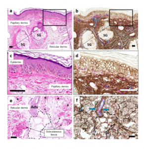 Interstitial spaces are continuous across tissue and organ boundaries ...
