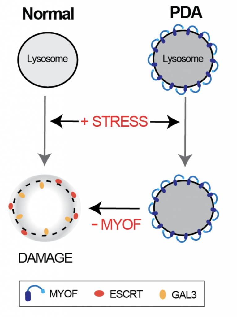 Lysosomal retargeting of Myoferlin mitigates membrane stress to enable ...