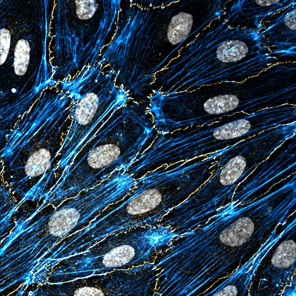 ARHGEF18 participates in Endothelial Cell Mechano-sensitivity in ...