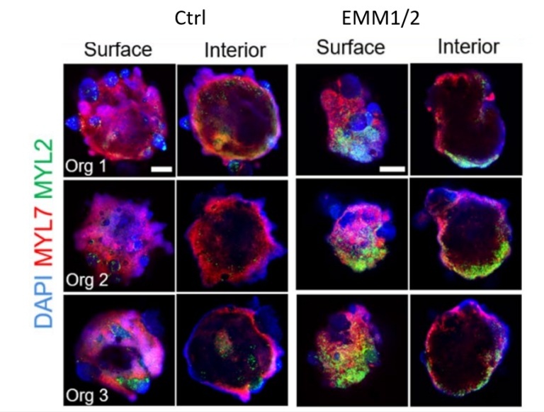 A patterned human heart tube organoid model generated by pluripotent ...