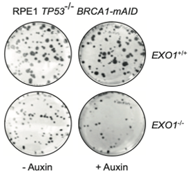 EXO1-mediated DNA repair by single-strand annealing is essential for ...
