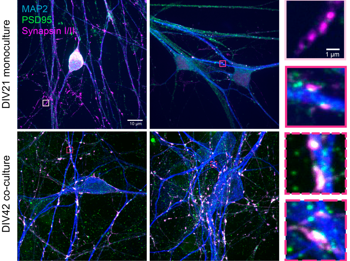 Spastin locally amplifies microtubule dynamics to pattern the axon for ...