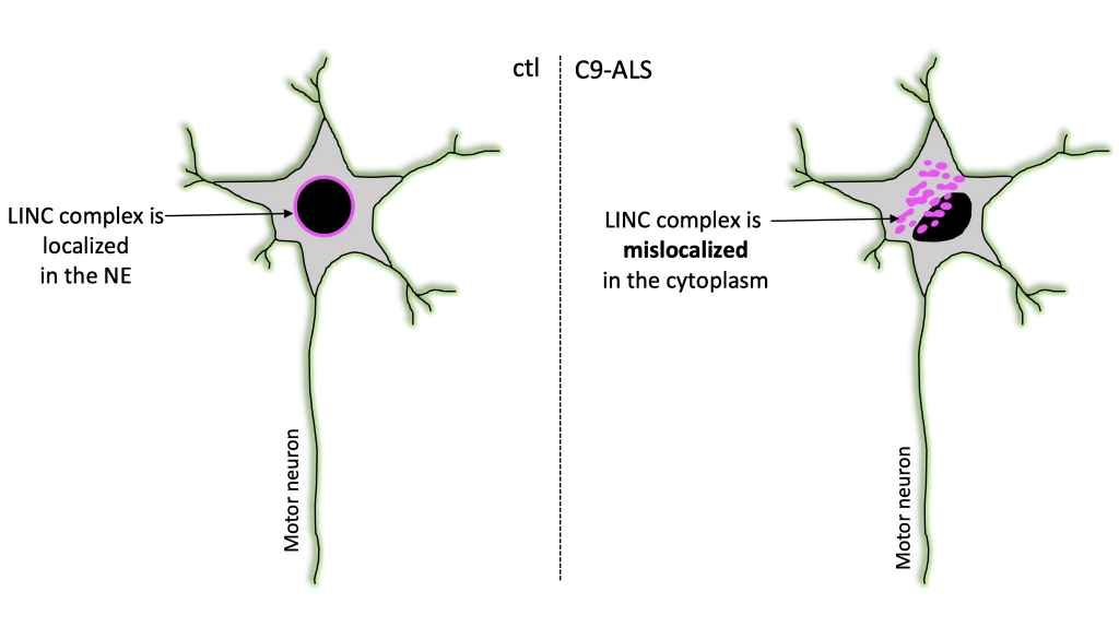 LINC complex alterations are a hallmark of sporadic and familial ALS ...